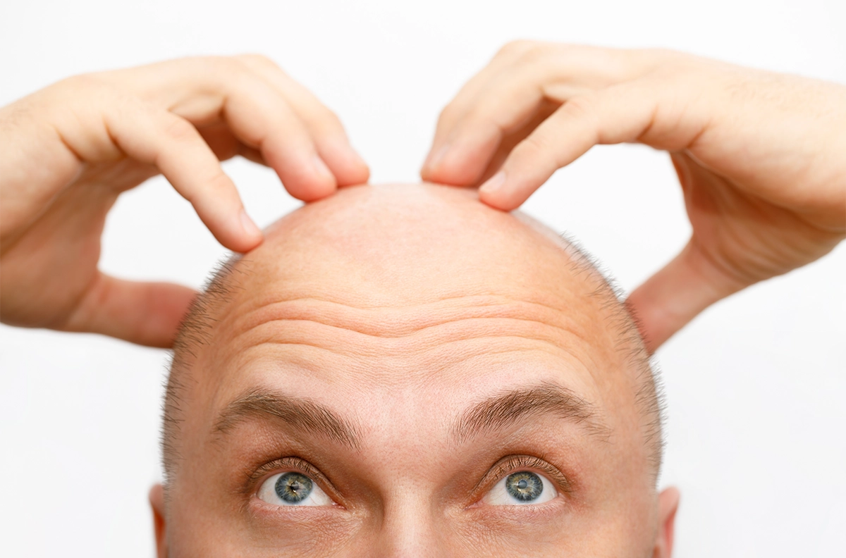 Does Hair Transplant Result in Failure? What should you pay attention ...