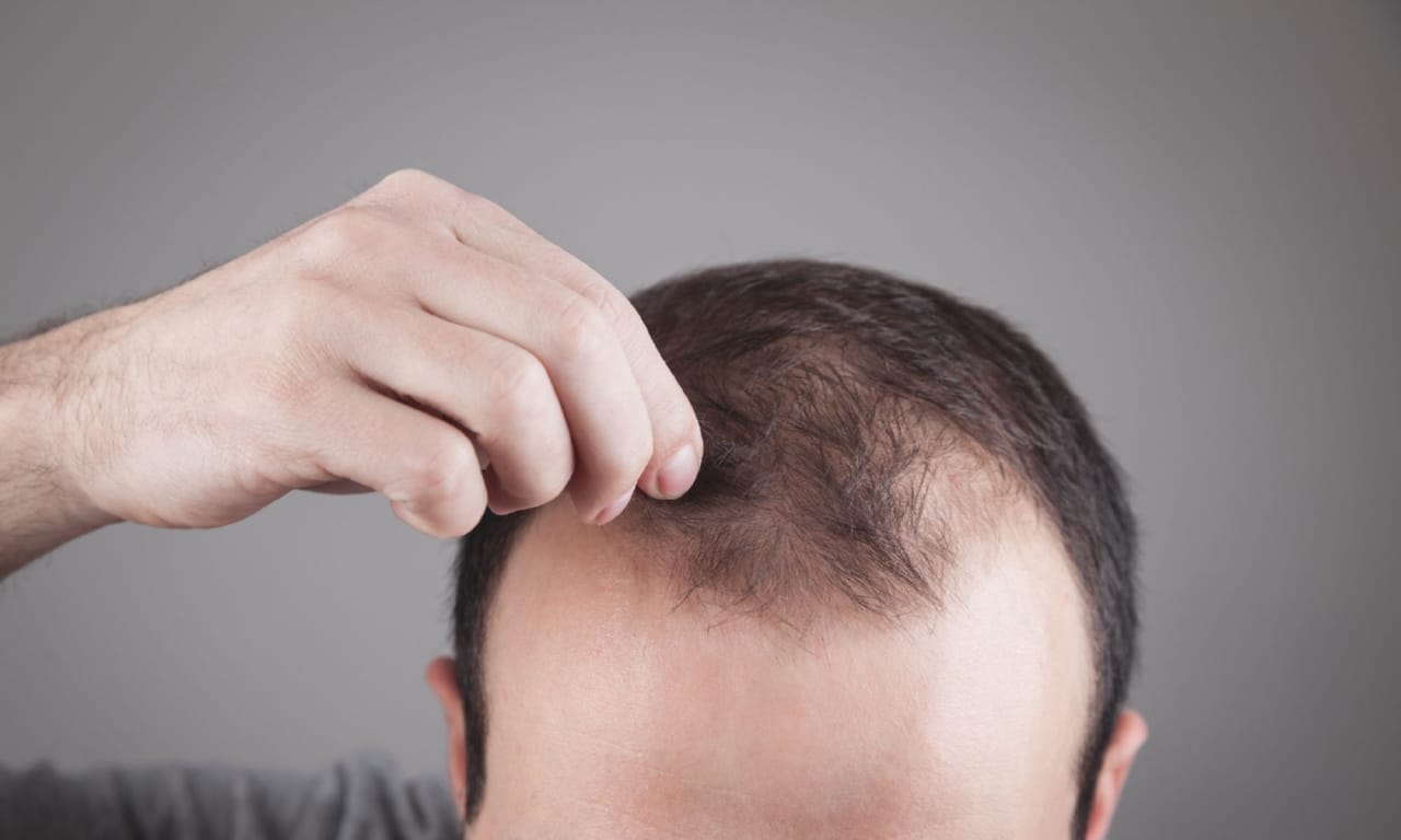 « Que se passe-t-il si la zone donneuse est insuffisante ? » – Faits et ...