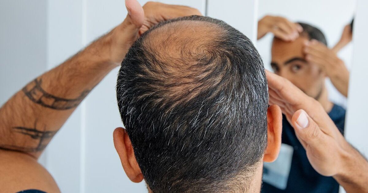 Symptome und Behandlungsmöglichkeiten für erblich bedingten Haarausfall ...